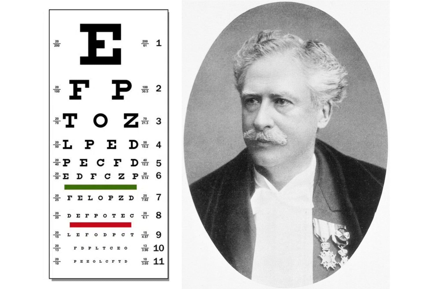 Snellen Chart – REMO Since 1988
